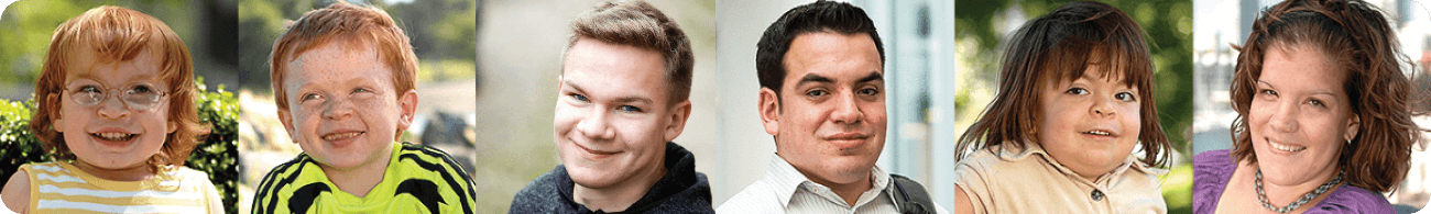 Livet med MPS type 1 | Symptomer og diagnoser på Sjældnesygdomme.dk